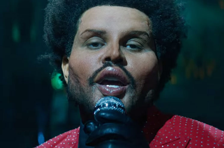 The Weeknd Got Quite the Plastic Surgery Job for His "Save Your Tears ...