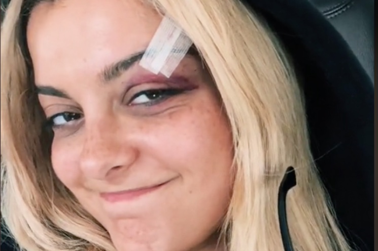 Man Who Threw Phone at Bebe Rexha's Face Thought "It Would Be Funny ...