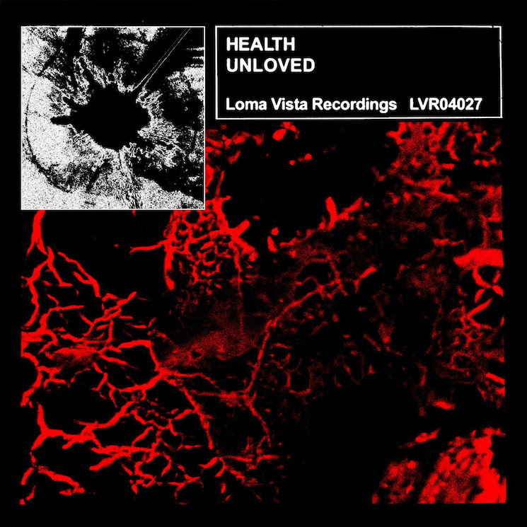 HEALTH Lean Into Goth Roots with New Single "UNLOVED" │ Exclaim!